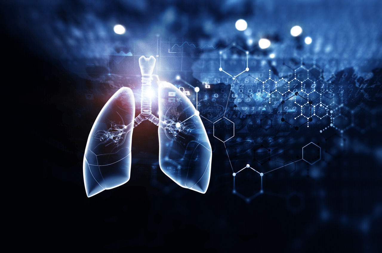 Using Natural Language Processing to Enhance Radiology | 1QBit